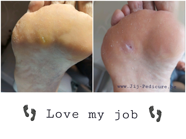 Jij-Pedicure - Nieuws