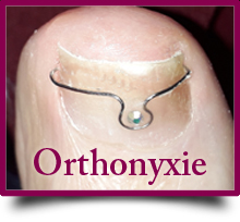 Jij-Pedicure - Nagelregulatie- techniek (Orthonyxie)